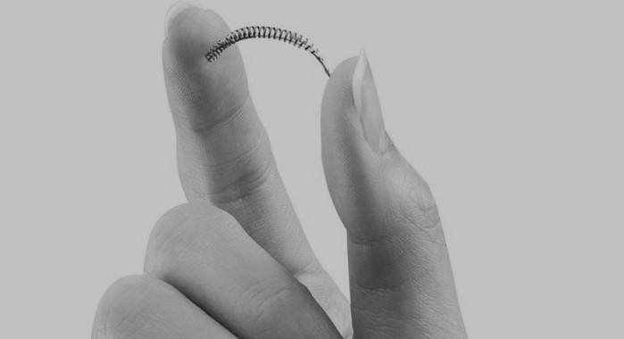 What is Essure? - Essure Problems
